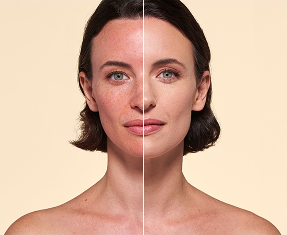 Vichy Dermablend Extra Cover Corrective Stick Foundation 35 Sand 9gr ...