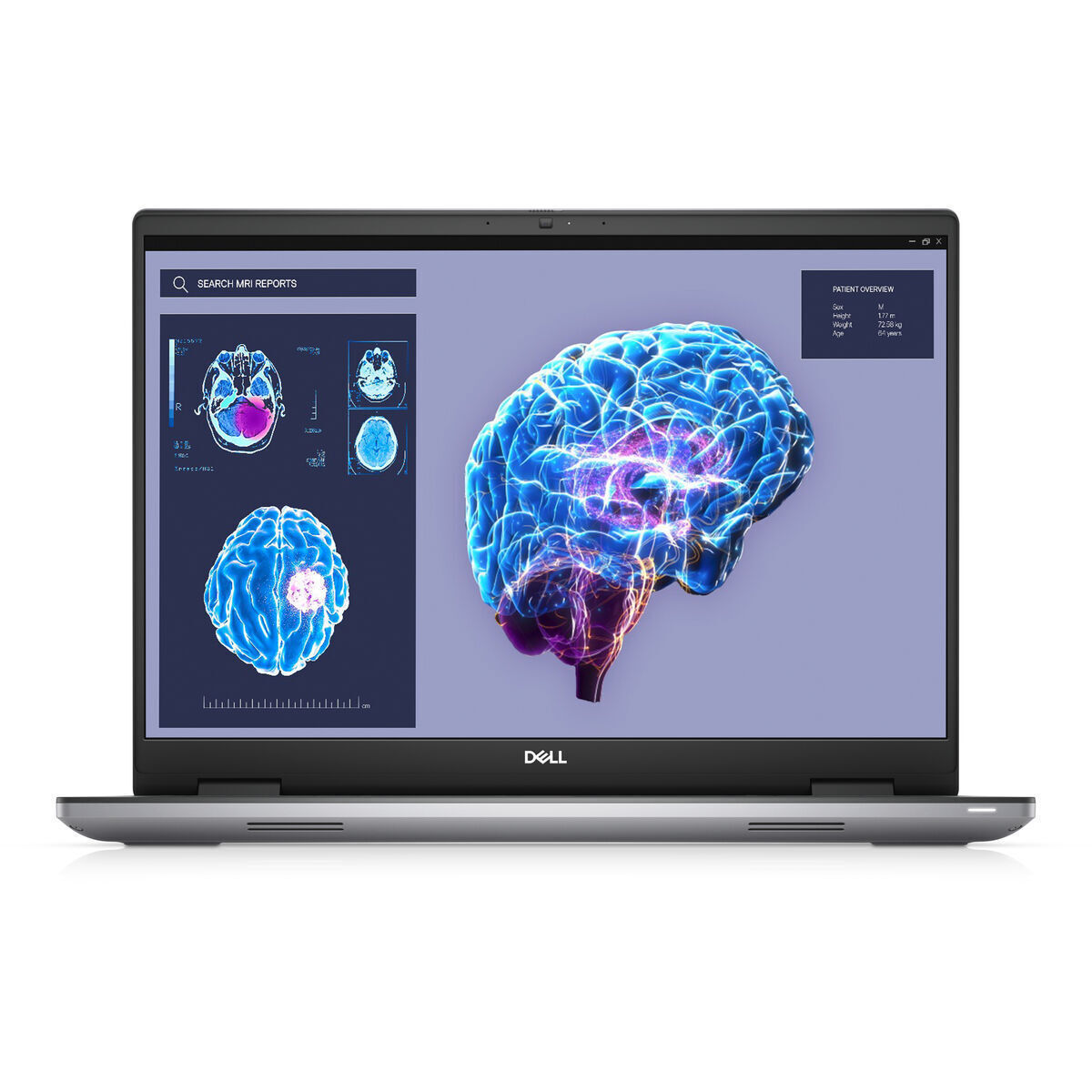 Dell Precision 7680 16" FHD+ (i7-13850HX/32GB/1TB SSD/RTX 2000 Ada/W11 ...